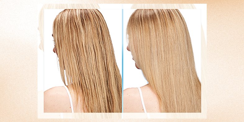 Greasy Hair: 15 Ways To Care for Oily Hair - L’Oréal Paris