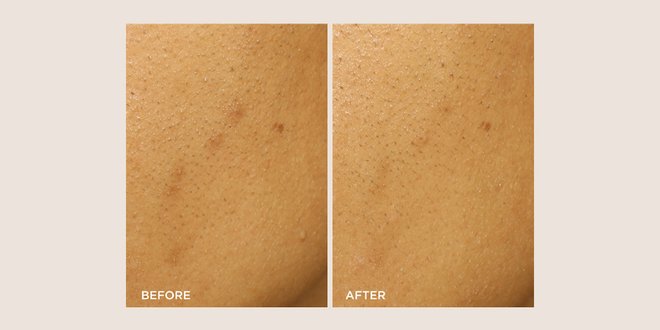 Everything To Know About PHAs in Skincare - L’Oréal Paris