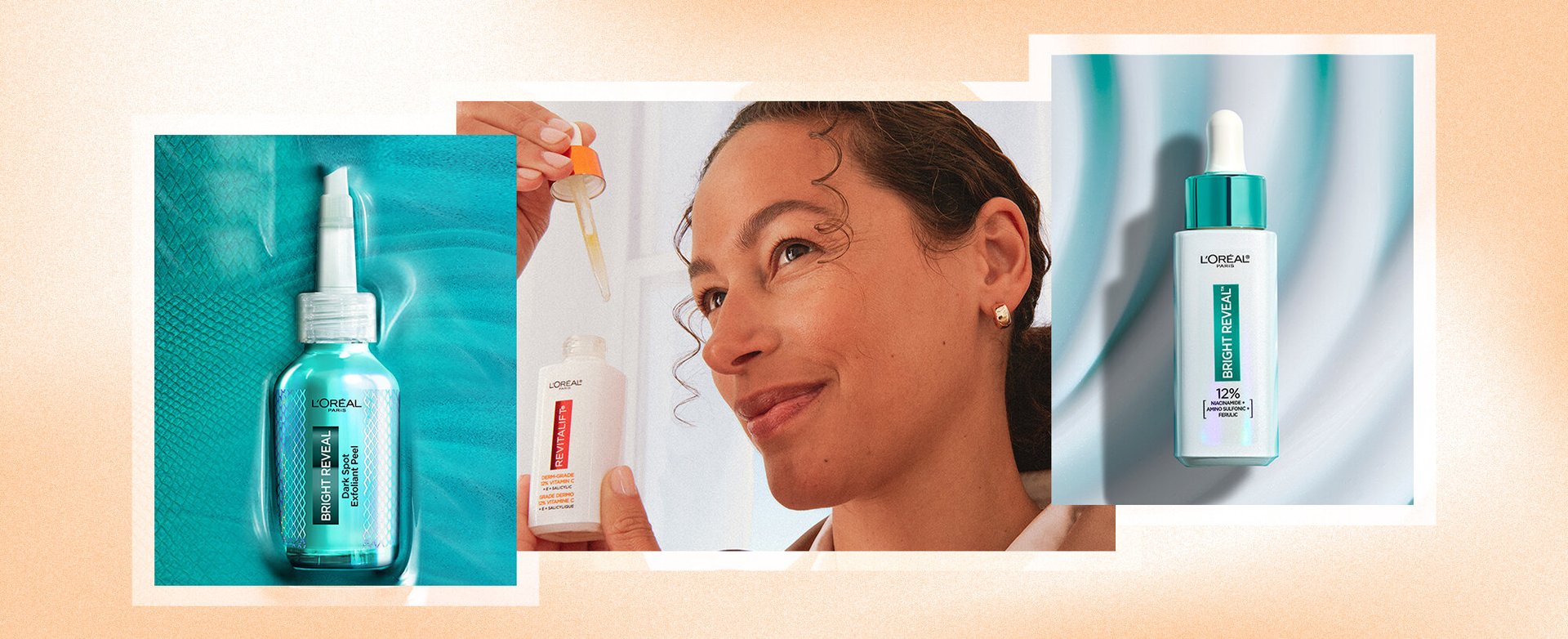 Skin Blemishes: 10 Types and How to Manage Them - L’Oréal Paris - L ...