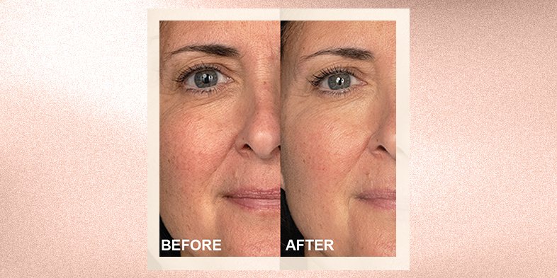 The Ultimate Guide: How to Apply Retinol - L’Oréal Paris