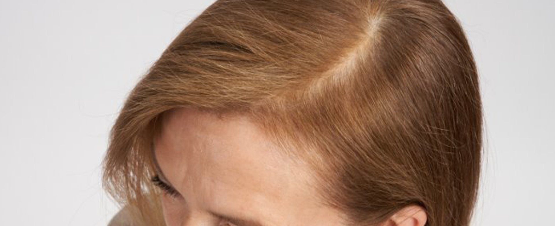 Woman with dry scalp