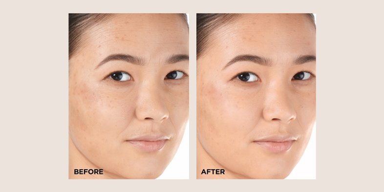 How To Use Hyaluronic Acid With Vitamin C | L’Oréal Paris