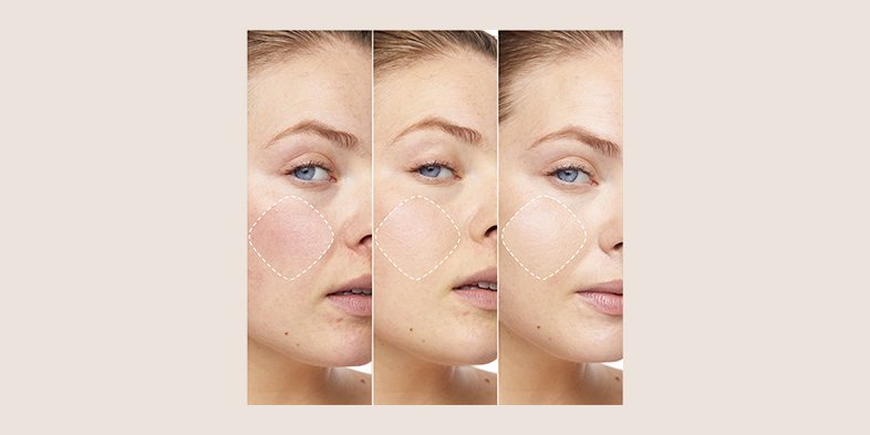 Primer vs. Moisturizer: Which to Apply First | L’Oréal Paris
