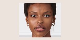 What Causes Ruddy Skin & How to Manage It - L’Oréal Paris