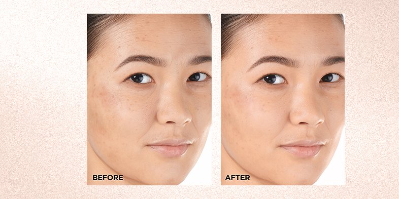 10 Tips To Get Smooth Skin | L’Oréal Paris