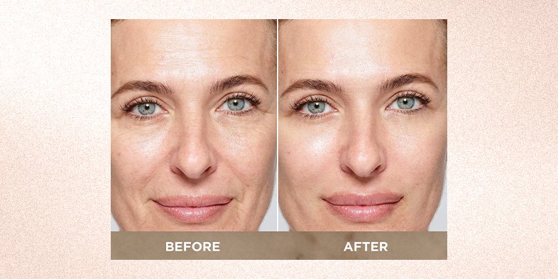 10 Tips To Get Smooth Skin | L’Oréal Paris