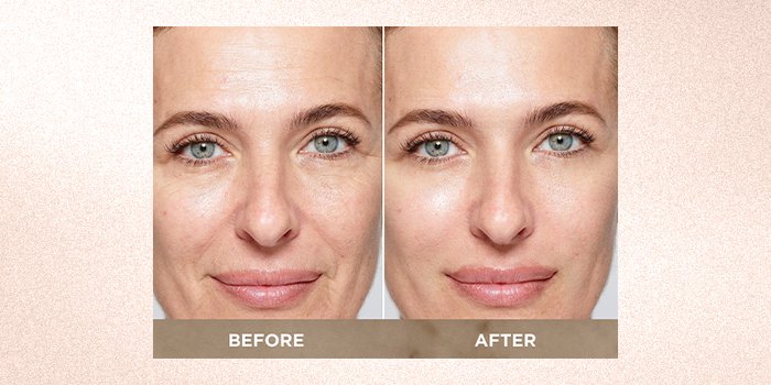 10 Tips To Get Smooth Skin | L’Oréal Paris