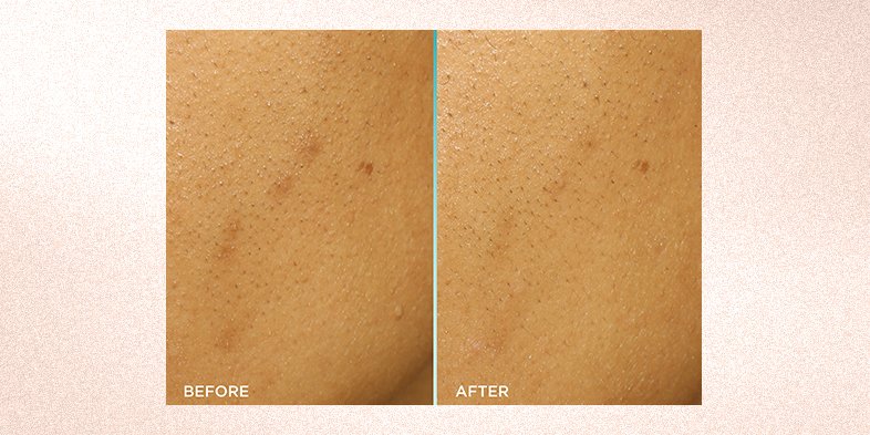 10 Tips To Get Smooth Skin | L’Oréal Paris