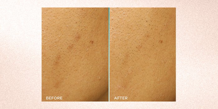 10 Tips To Get Smooth Skin | L’Oréal Paris