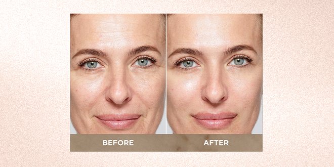 How To Achieve Radiant Skin | L’Oréal Paris