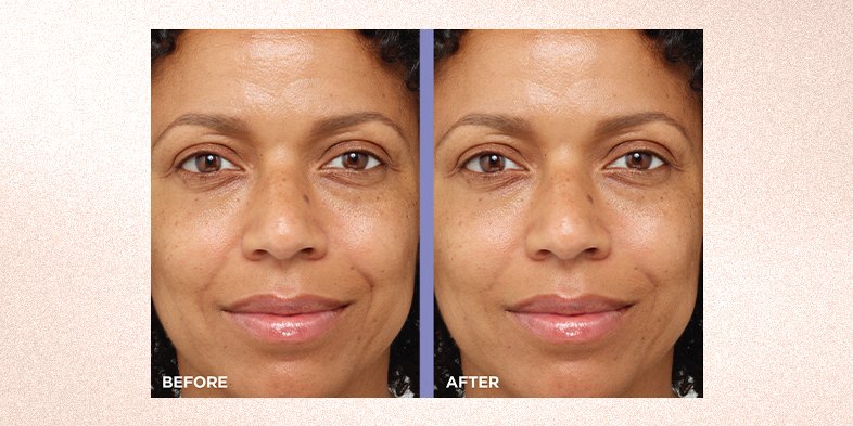 Primer vs. Moisturizer: Which to Apply First | L’Oréal Paris