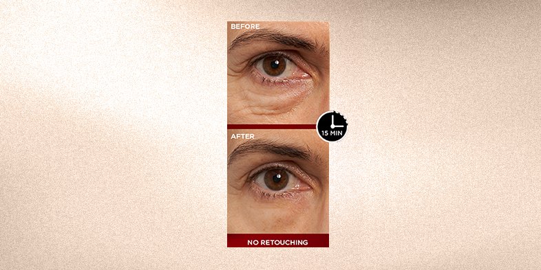 How To Get Rid of Eye Bags: 14 Tricks That Actually Work | L’Oréal Paris