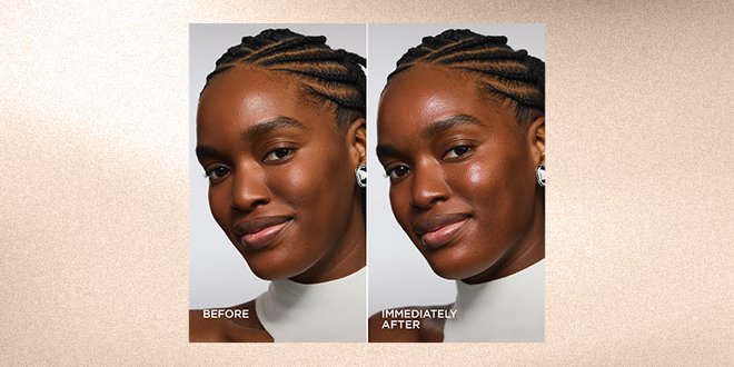 Why Is My Face Peeling & How To Address It | L’Oréal Paris