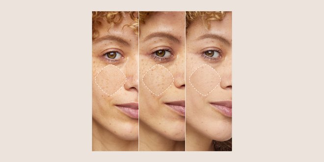 6 Tips for Minimizing Large Pores With Makeup | L’Oréal Paris