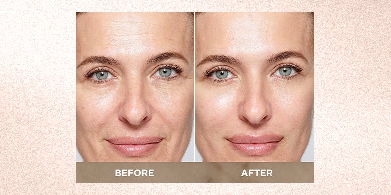 How To Brighten Dull Skin | L’Oréal Paris