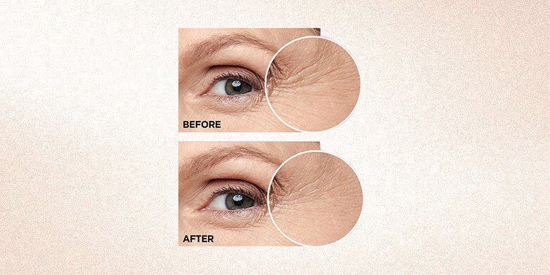 How To Prevent and Treat Fine Lines Under Eyes | L’Oréal Paris
