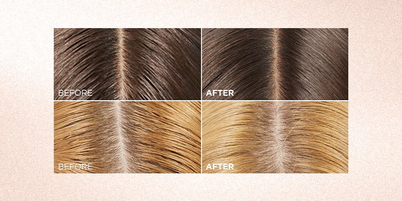 How To Balance Sebum on Scalp for Healthier Hair | L’Oréal Paris