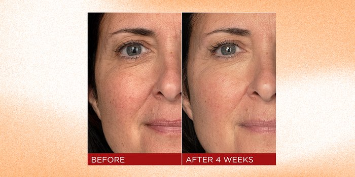 How To Brighten Your Skin: 7 Helpful Tips | L’Oréal Paris