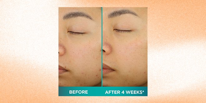 How To Brighten Your Skin: 7 Helpful Tips | L’Oréal Paris