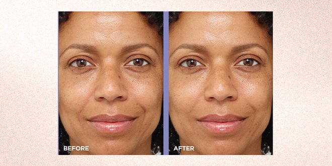 12 Tips To Help You Get Clear Skin | L’Oréal Paris