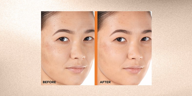 7 Reasons To Add a Face Serum To Your Routine | L’Oréal Paris