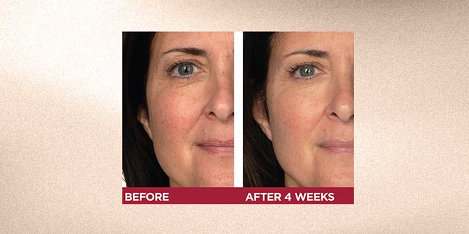 Skin Blemishes: 10 Types and How to Manage Them | L’Oréal Paris