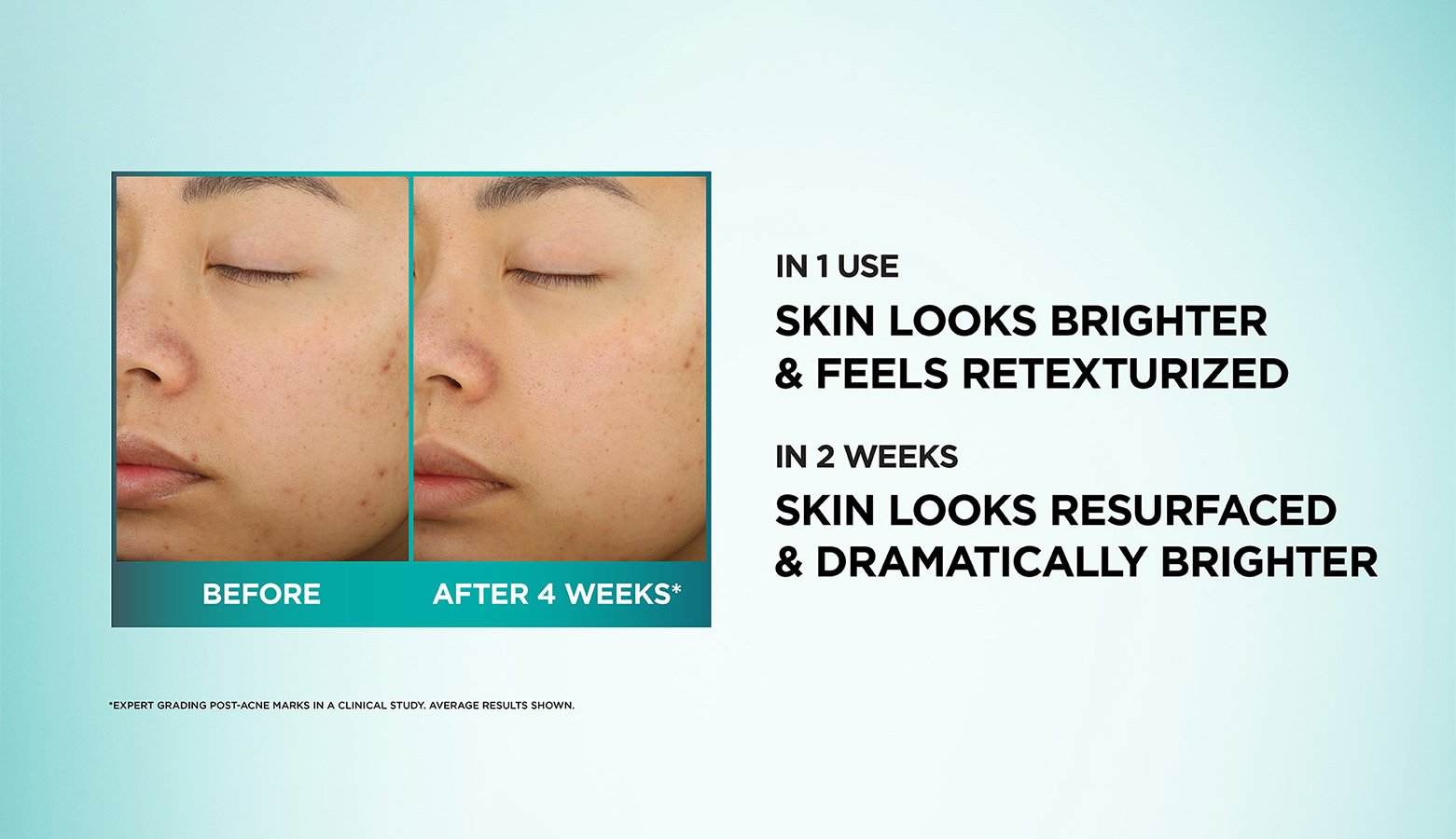 Bright Reveal Dark Spot Exfoliant Peel - L'Oréal Paris