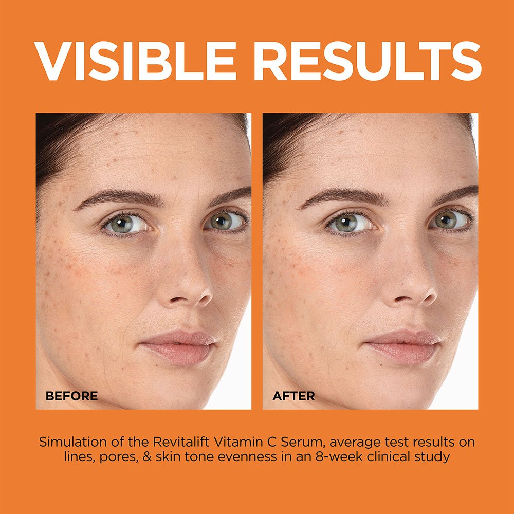 Revitalift Vitamin C+E Salicylic Acid Serum - L’Oréal Paris