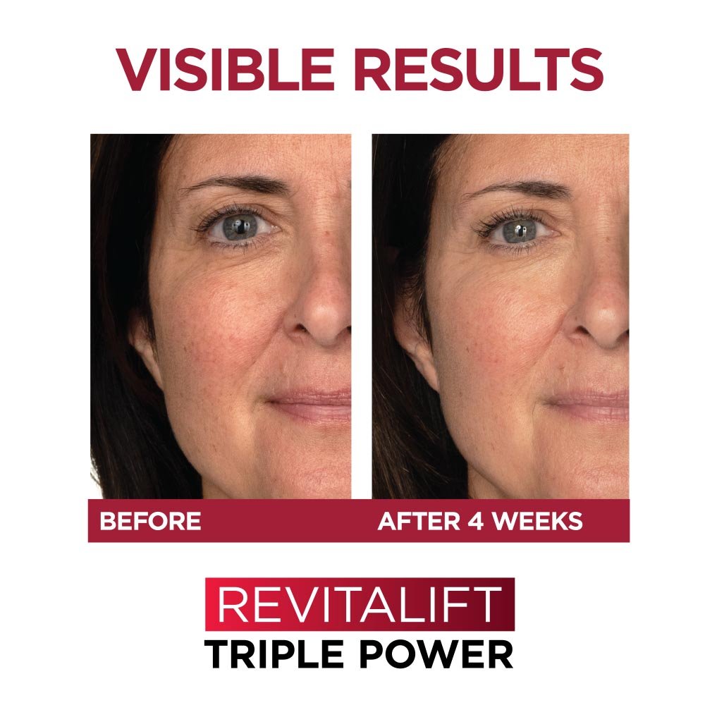 RevitaLift Triple Power Anti-Aging Day Moisturizer - L'Oréal Paris